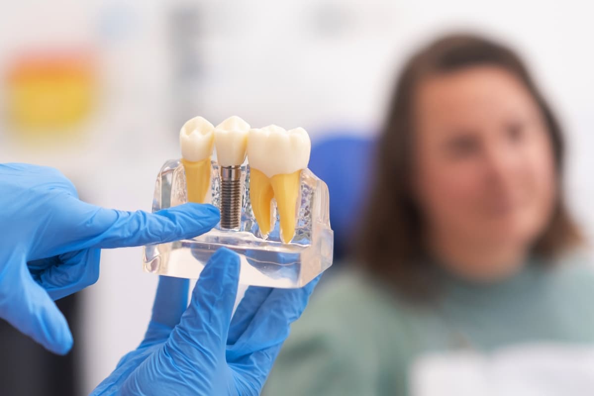 Titanium Implants: Corrosion Risks And Longevity